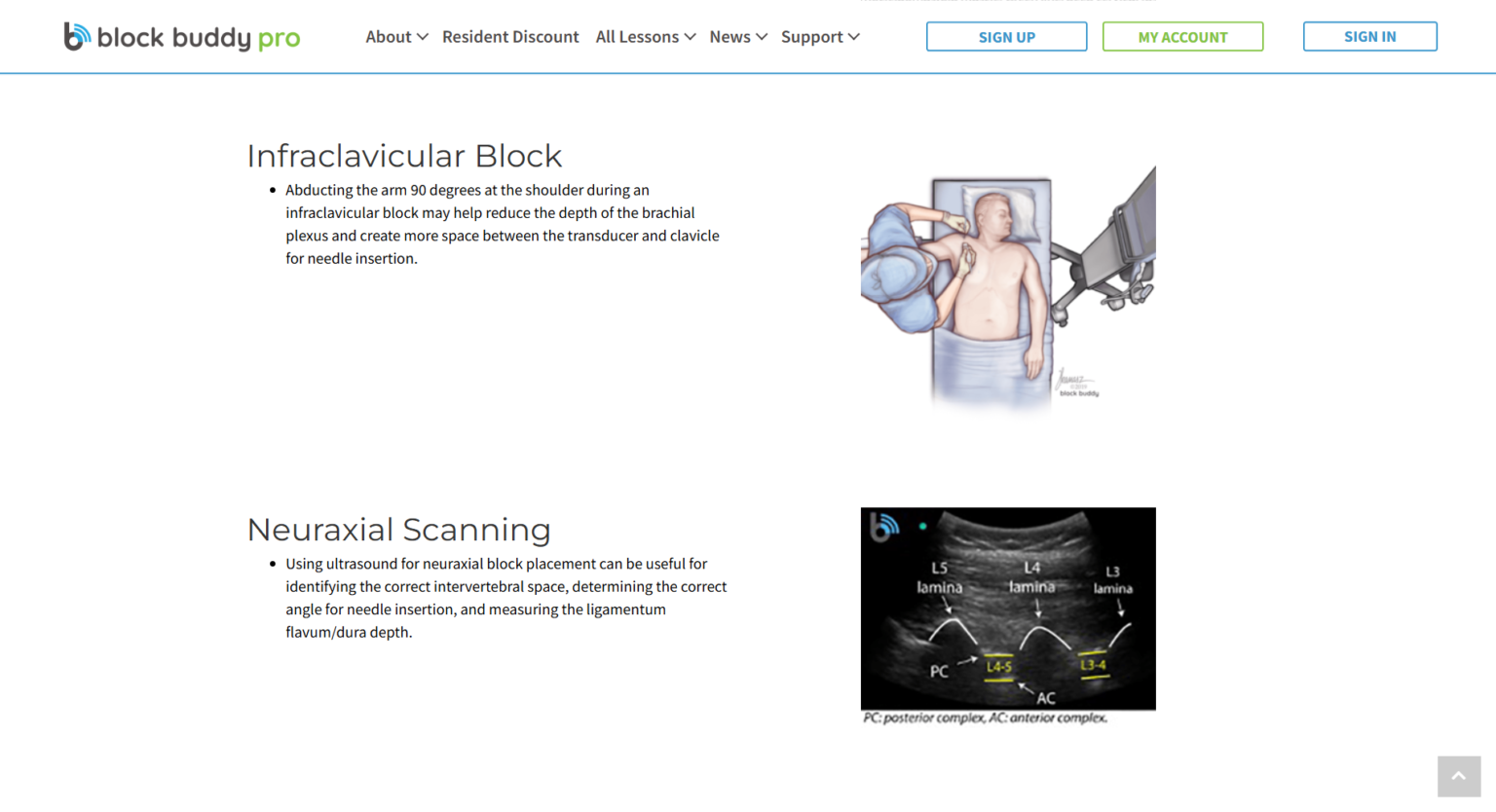 Block Buddy Pro – Adiksu Technologies