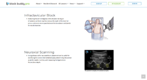 Block Buddy Pro – Adiksu Technologies