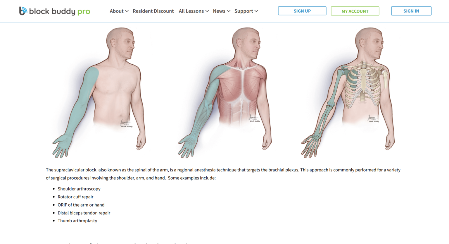 Block Buddy Pro – Adiksu Technologies